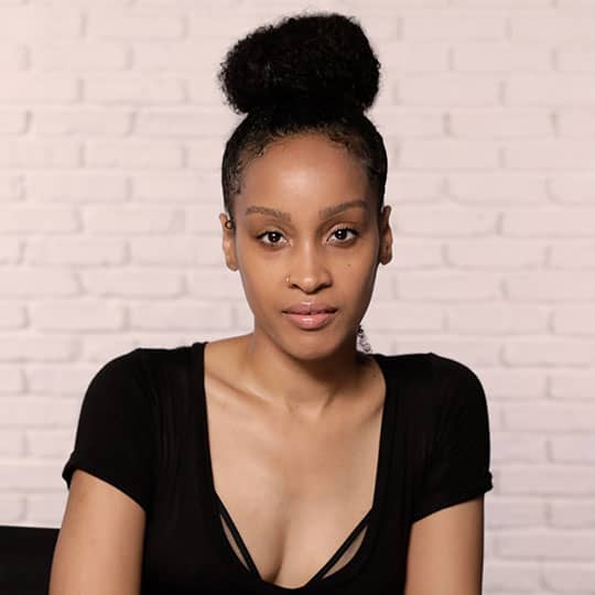 thinning receding hairline women